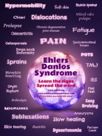 EDS Awareness Month | pdworkman.com